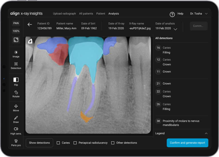Align X-ray Insights