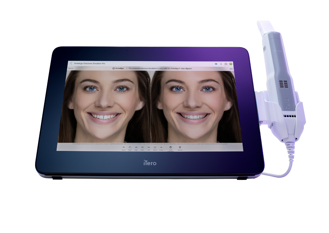 Intraoral scanners | iTero