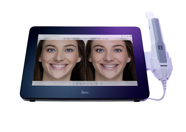 Intraoral scanners | iTero
