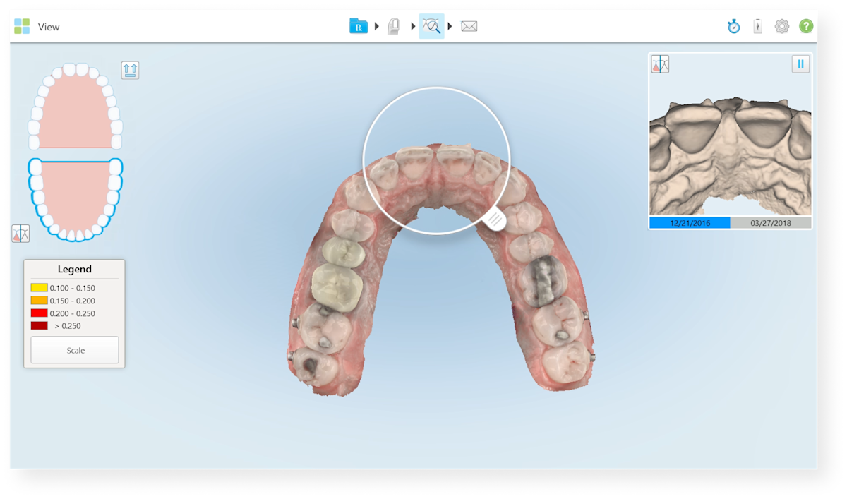 Expand restorative practice | iTero