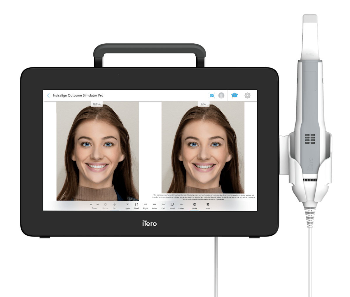 Element plus series | iTero