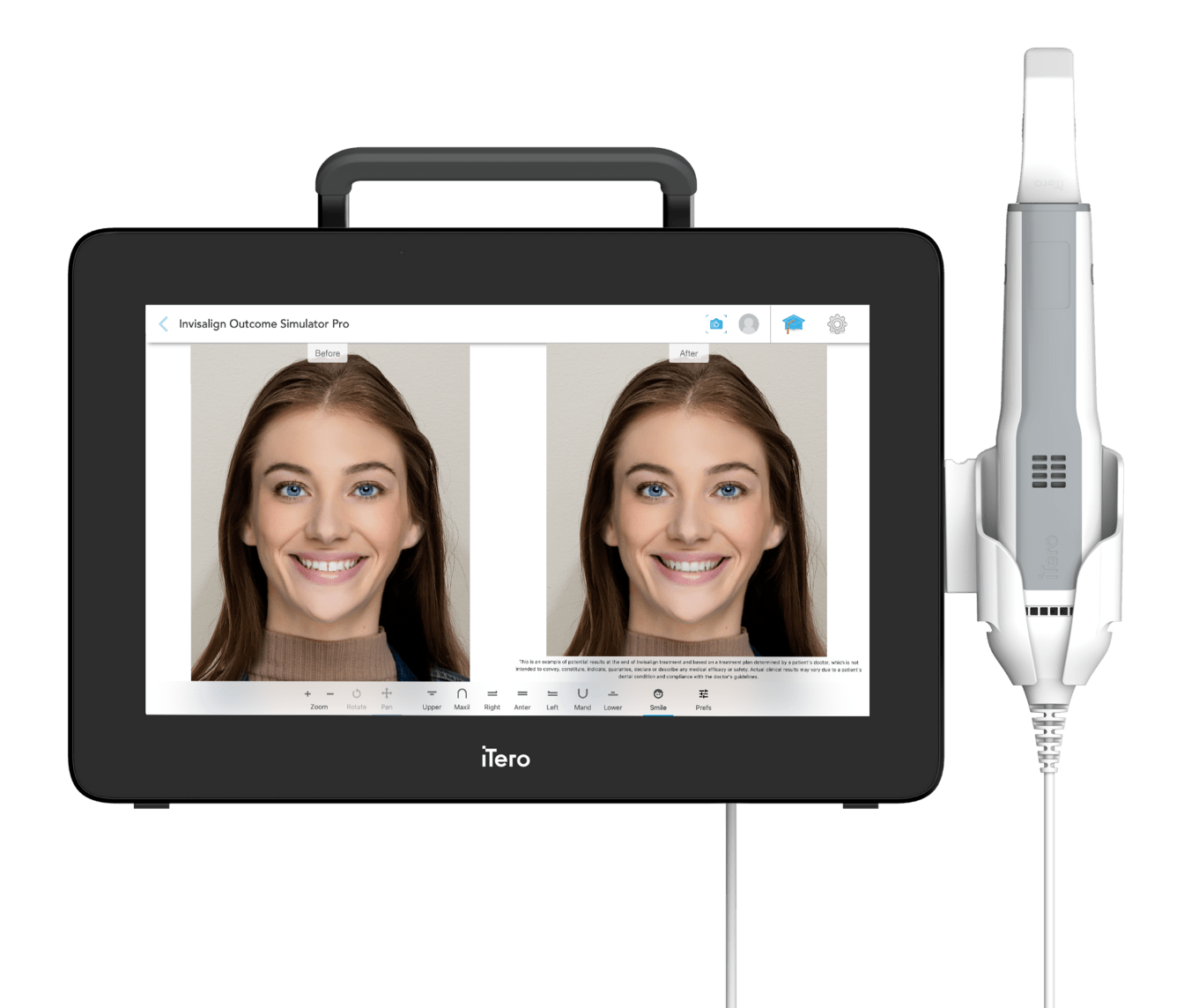 Element plus series | iTero