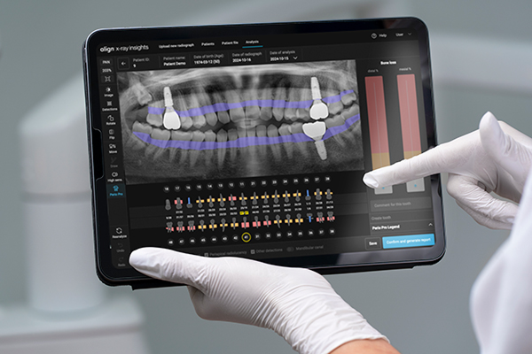 Align X-ray Insights