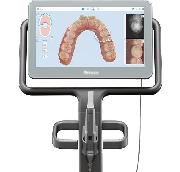 Intraoral Scanner | Align Technology | The iTero Element 5D