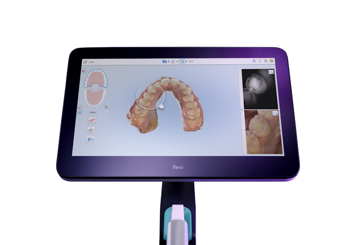 Intraoral scanners | iTero