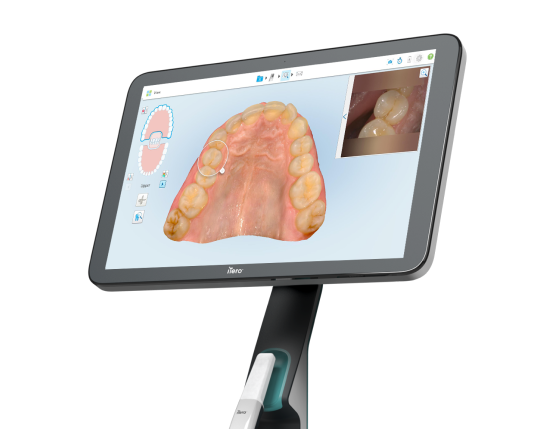 iTero Lumina™ intraoral scanner | iTero