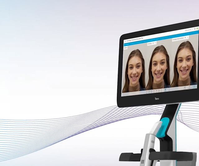 Element plus series | iTero