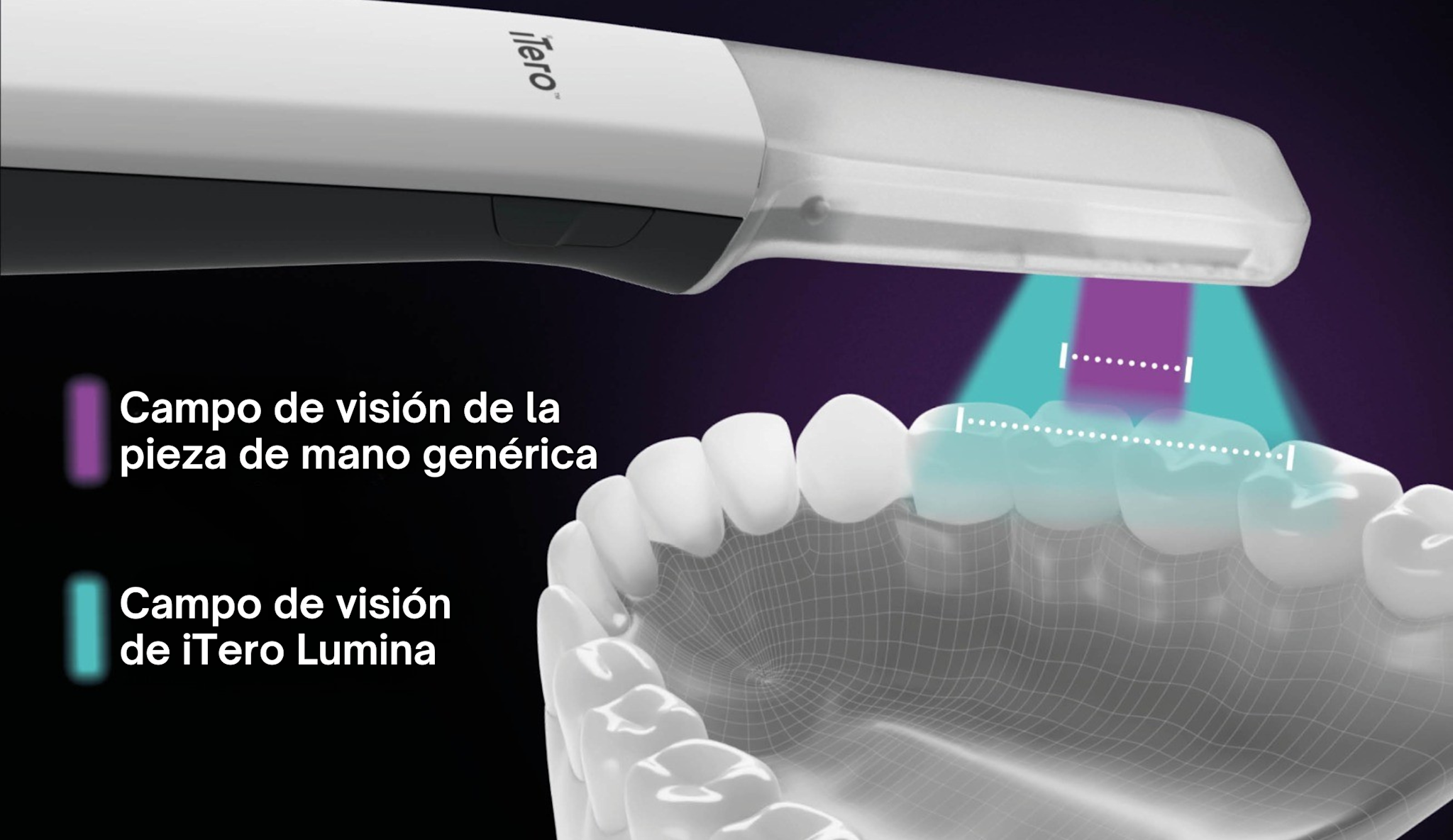 iTero Lumina™ escáner intraoral | iTero