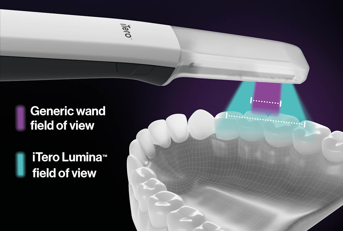 iTero Lumina™ intraoral scanner | iTero