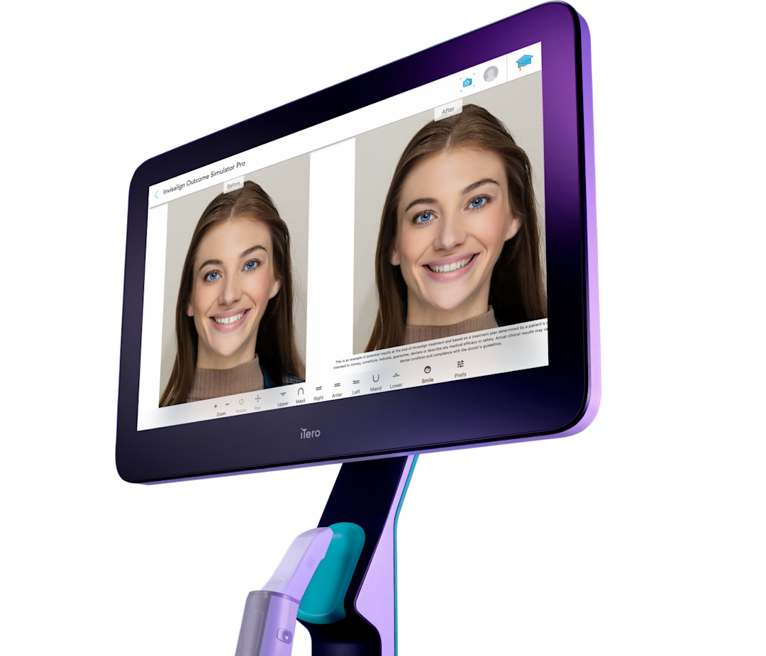 Serie Element Plus | iTero