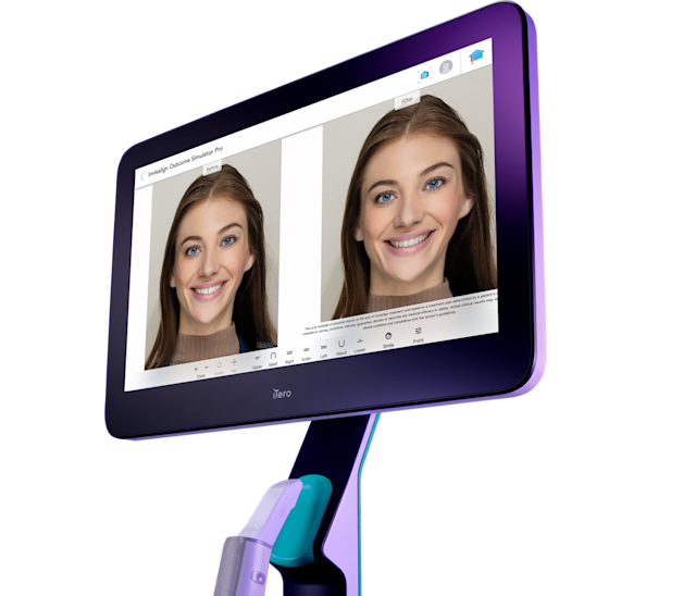 Serie Element Plus | iTero