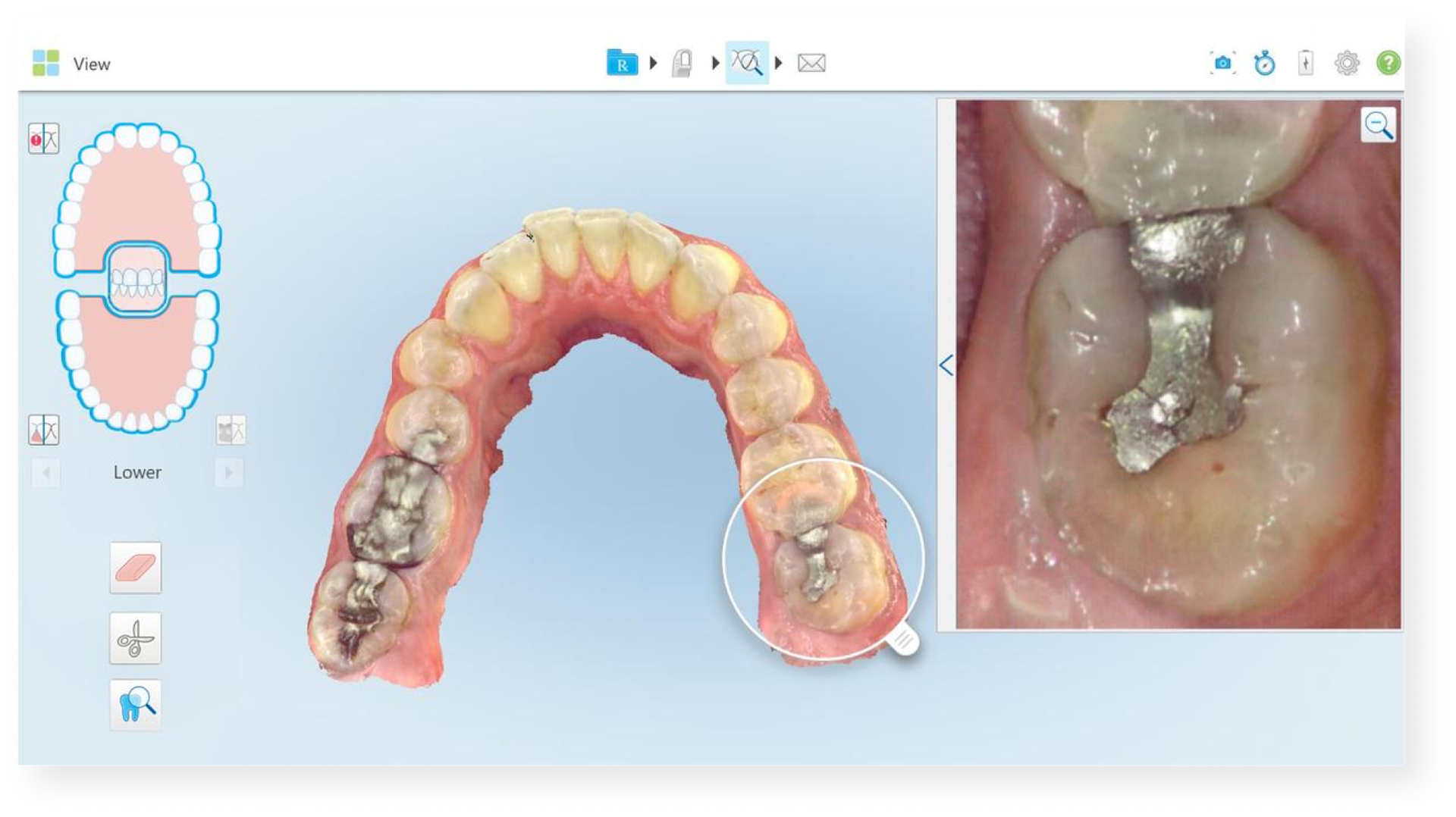 Expand restorative practice | iTero