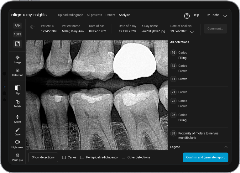 Align X-ray Insights