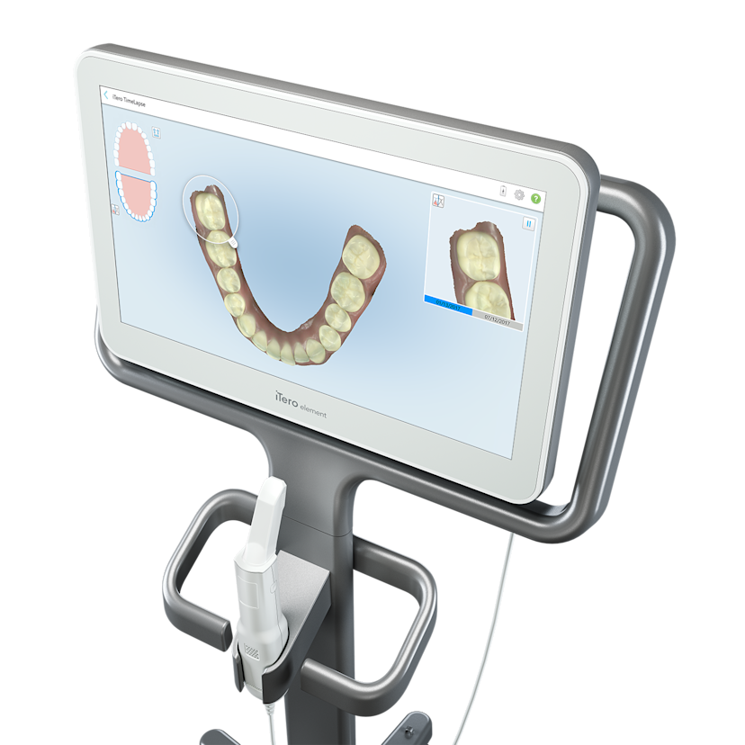 The iTero Element 2 imaging system | iTero