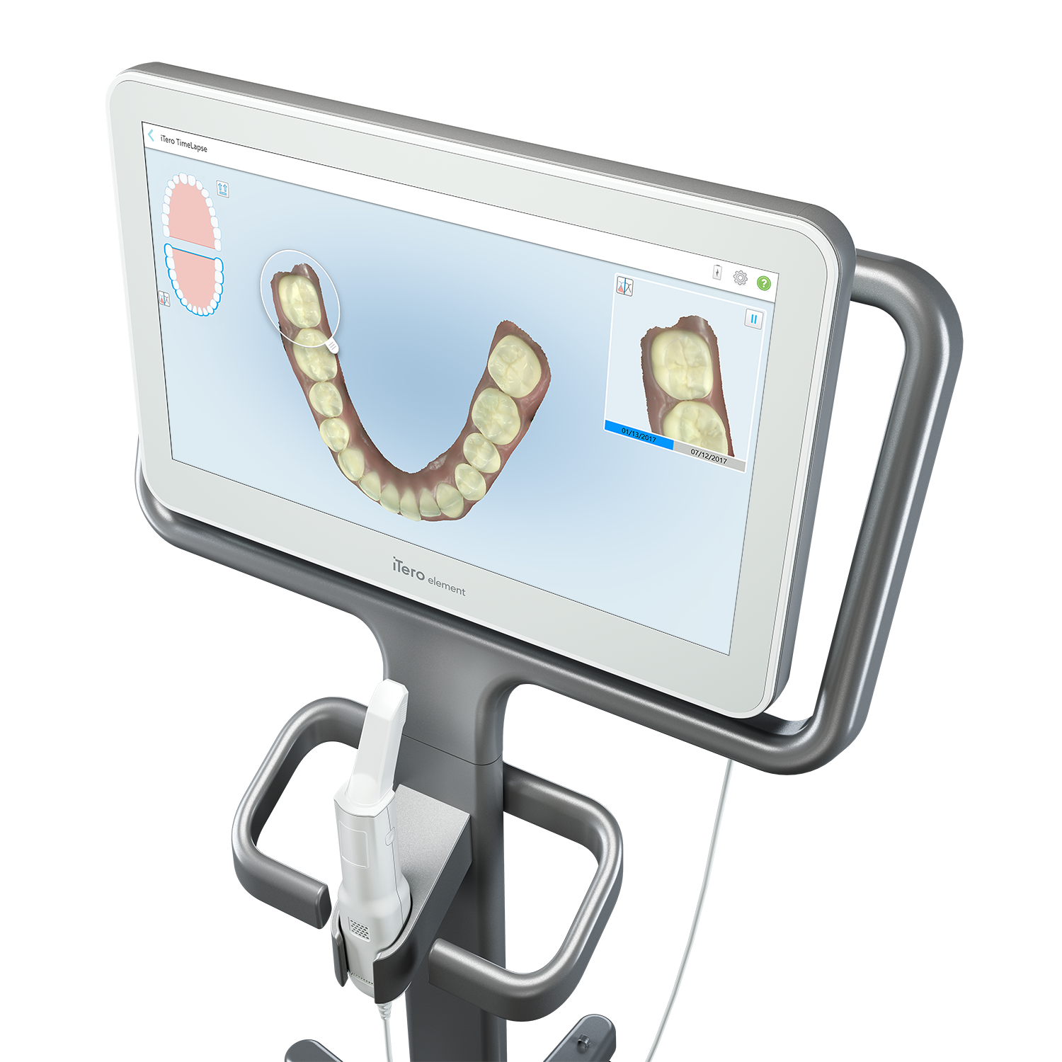 Escáner intraoral Element 2 | iTero