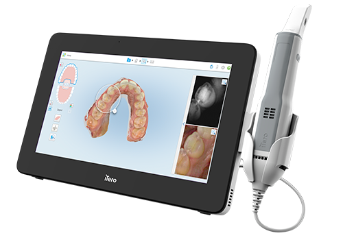 Diagnostics | iTero