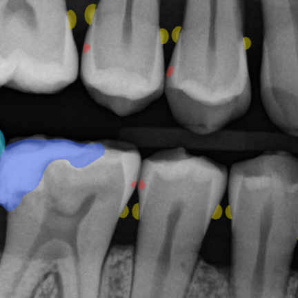 Align X-ray Insights | Home