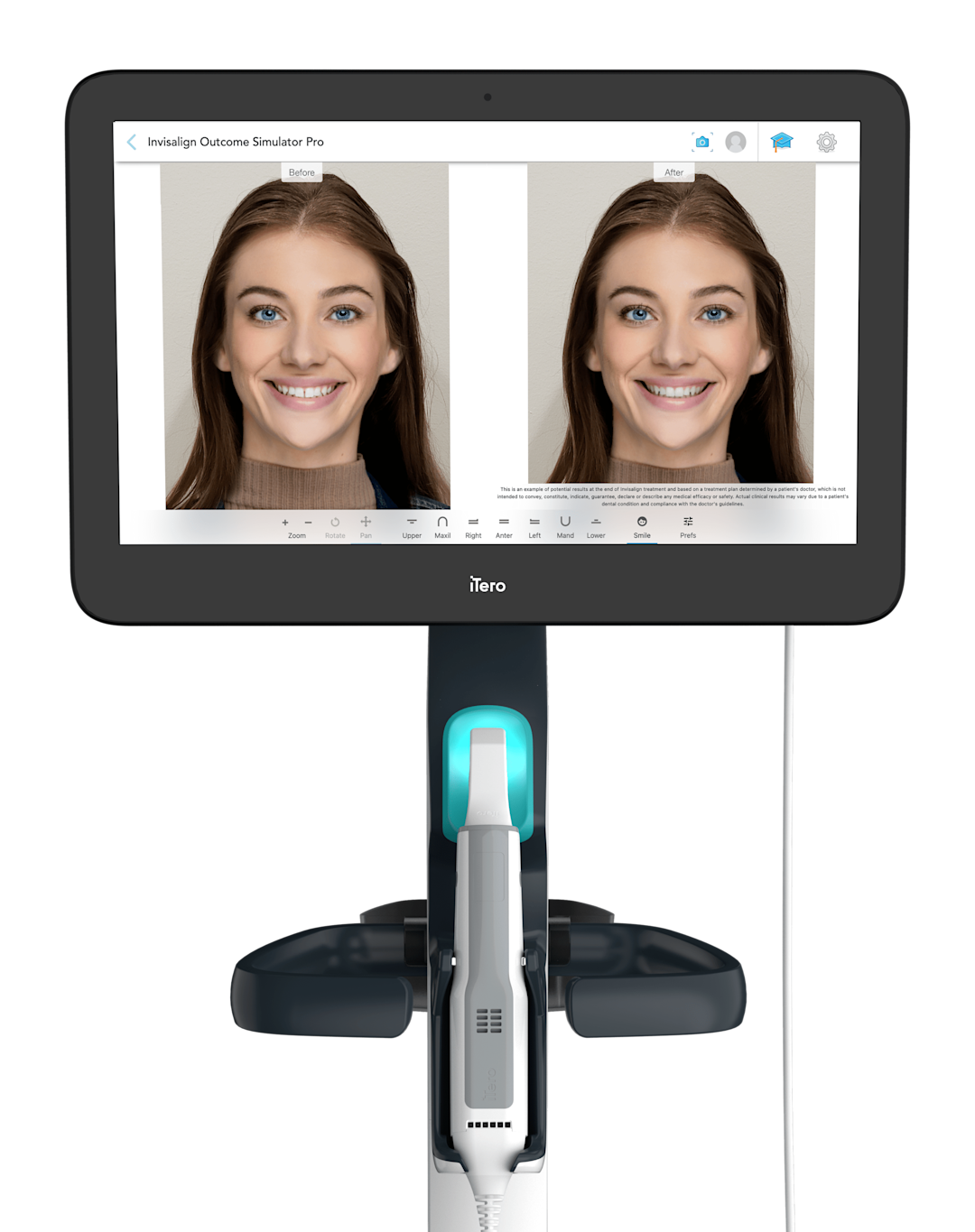 Element plus series | iTero