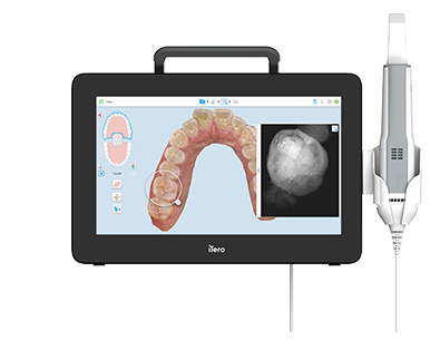 Our scanning solutions | iTero