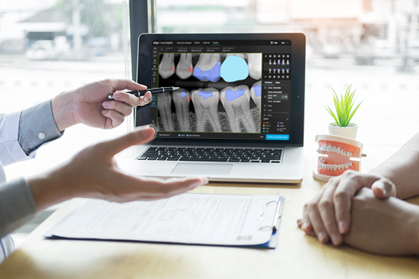 Align X-ray Insights