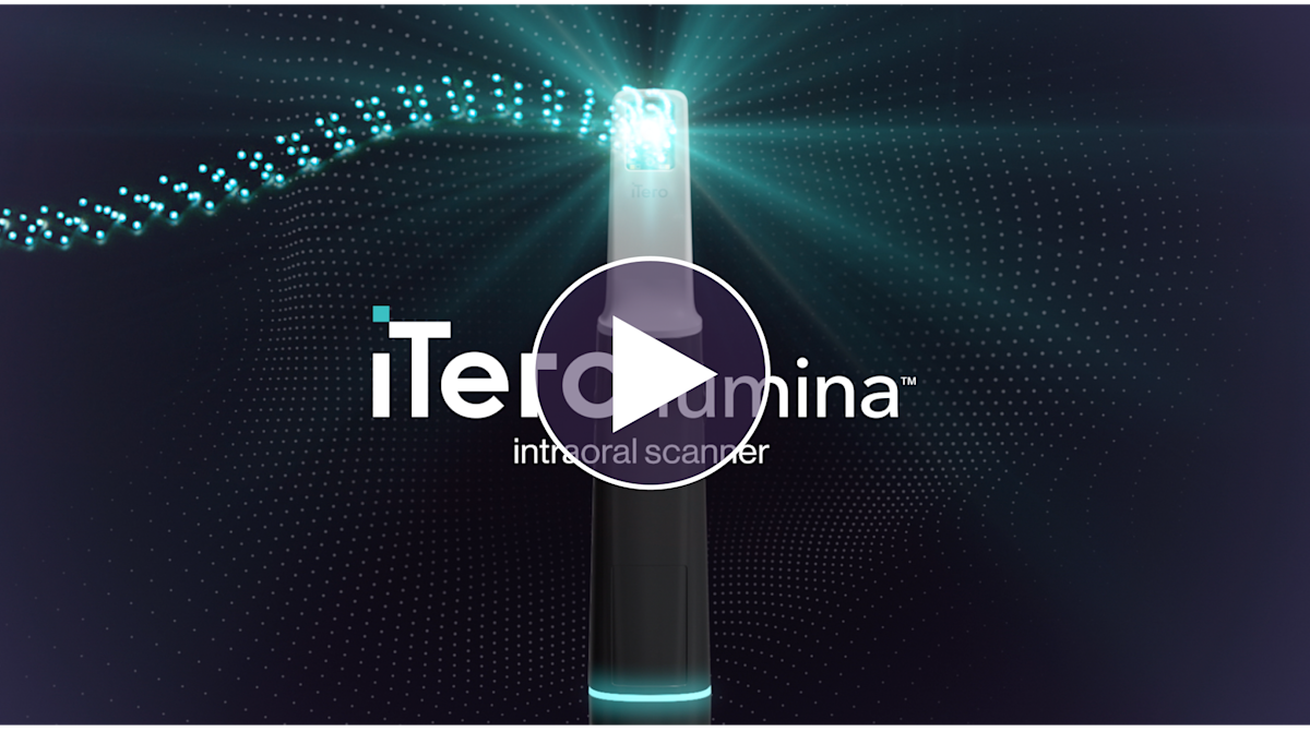iTero Lumina™ intraoral scanner | iTero