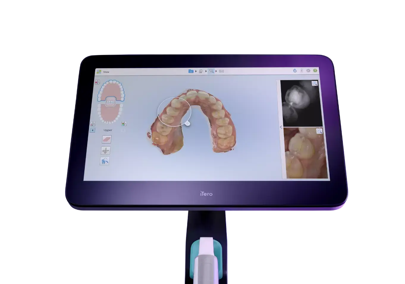 Intraoral scanners | iTero