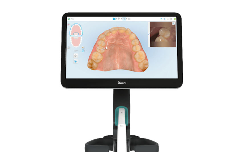 Our scanning solutions | iTero