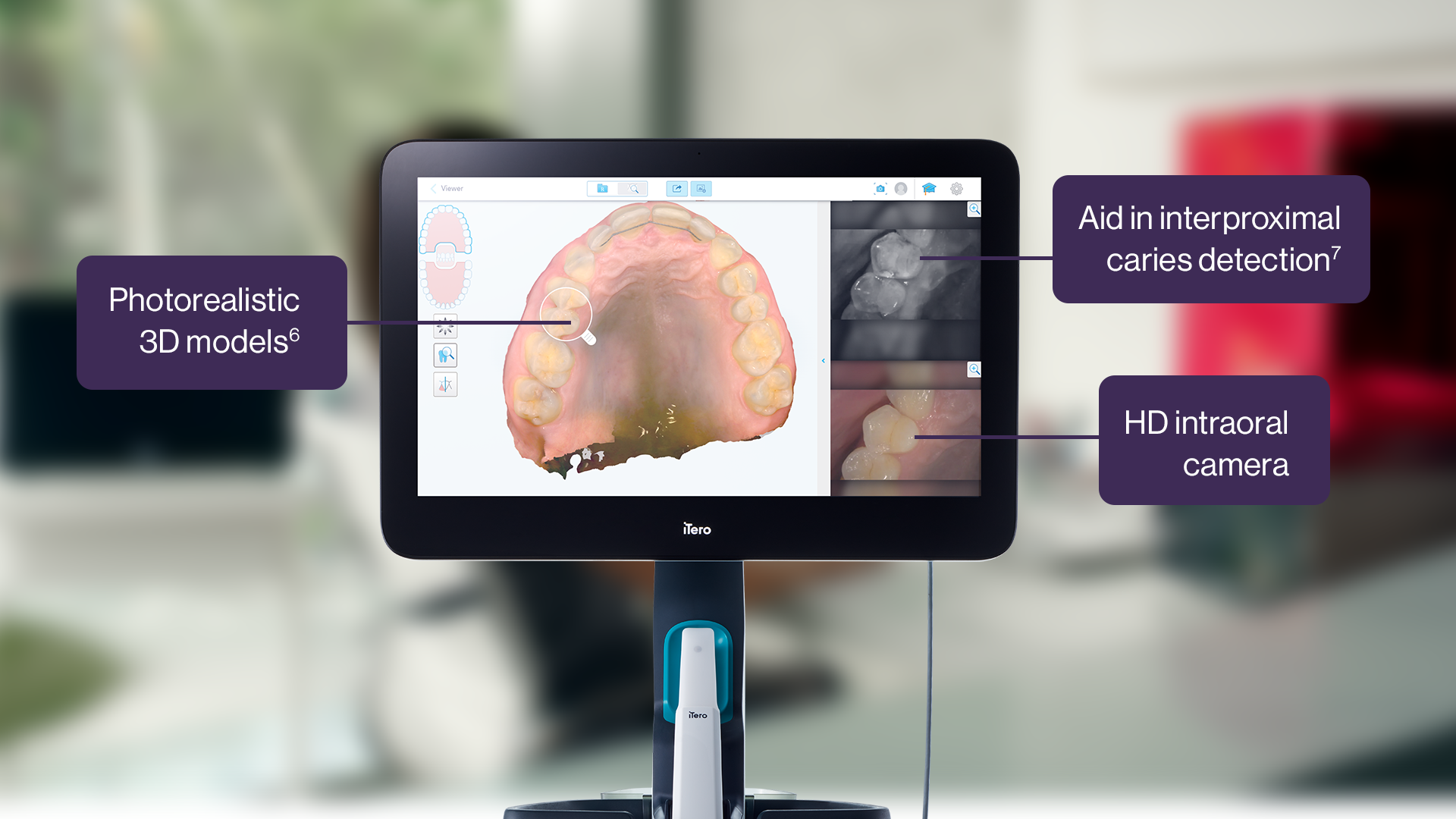 iTero Lumina™ intraoral scanner | iTero