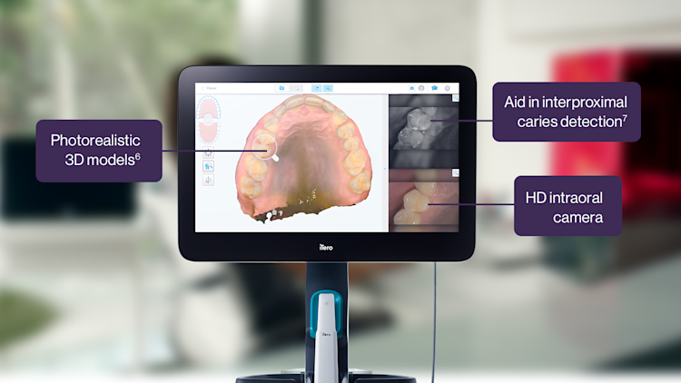 iTero Lumina™ intraoral scanner | iTero