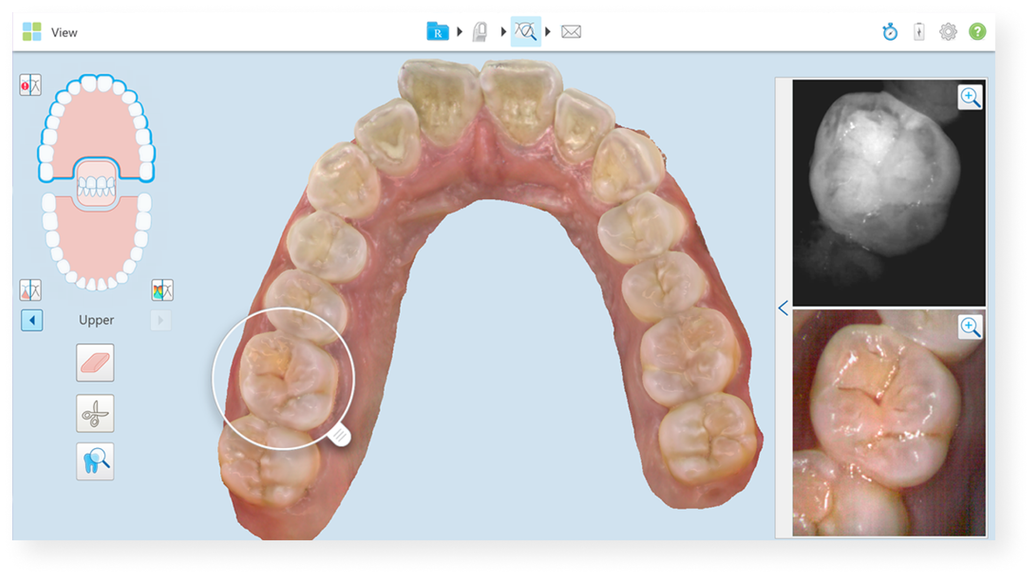 Expand restorative practice | iTero