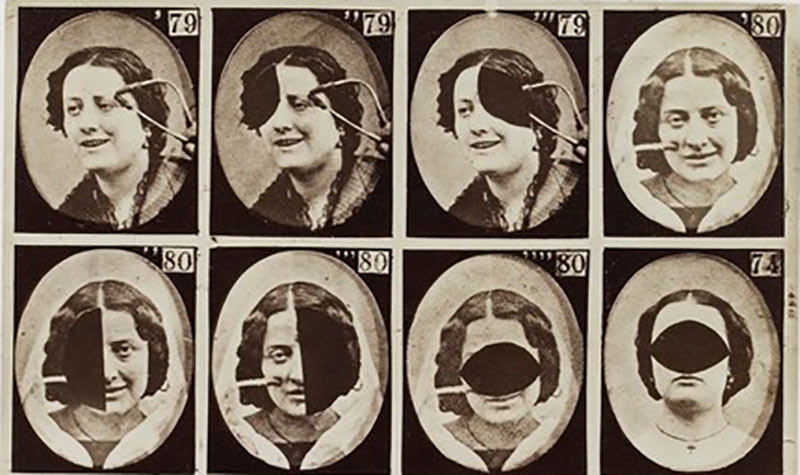 Say Cheese: facial expressions captured by Duchenne | Europeana