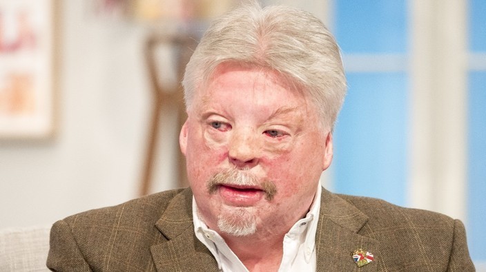 Falklands war hero Simon Weston shares life story | Lorraine