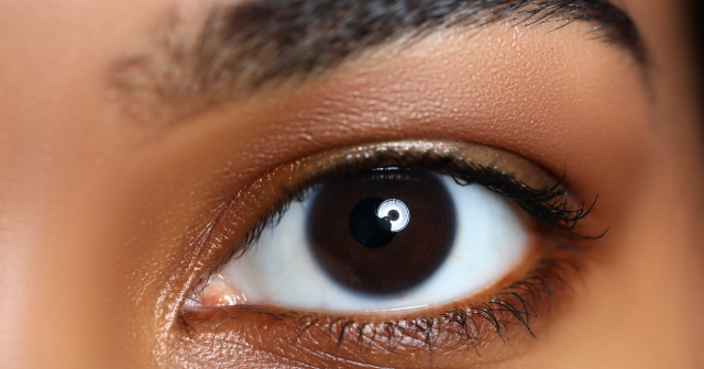 What is amaurosis fugax?