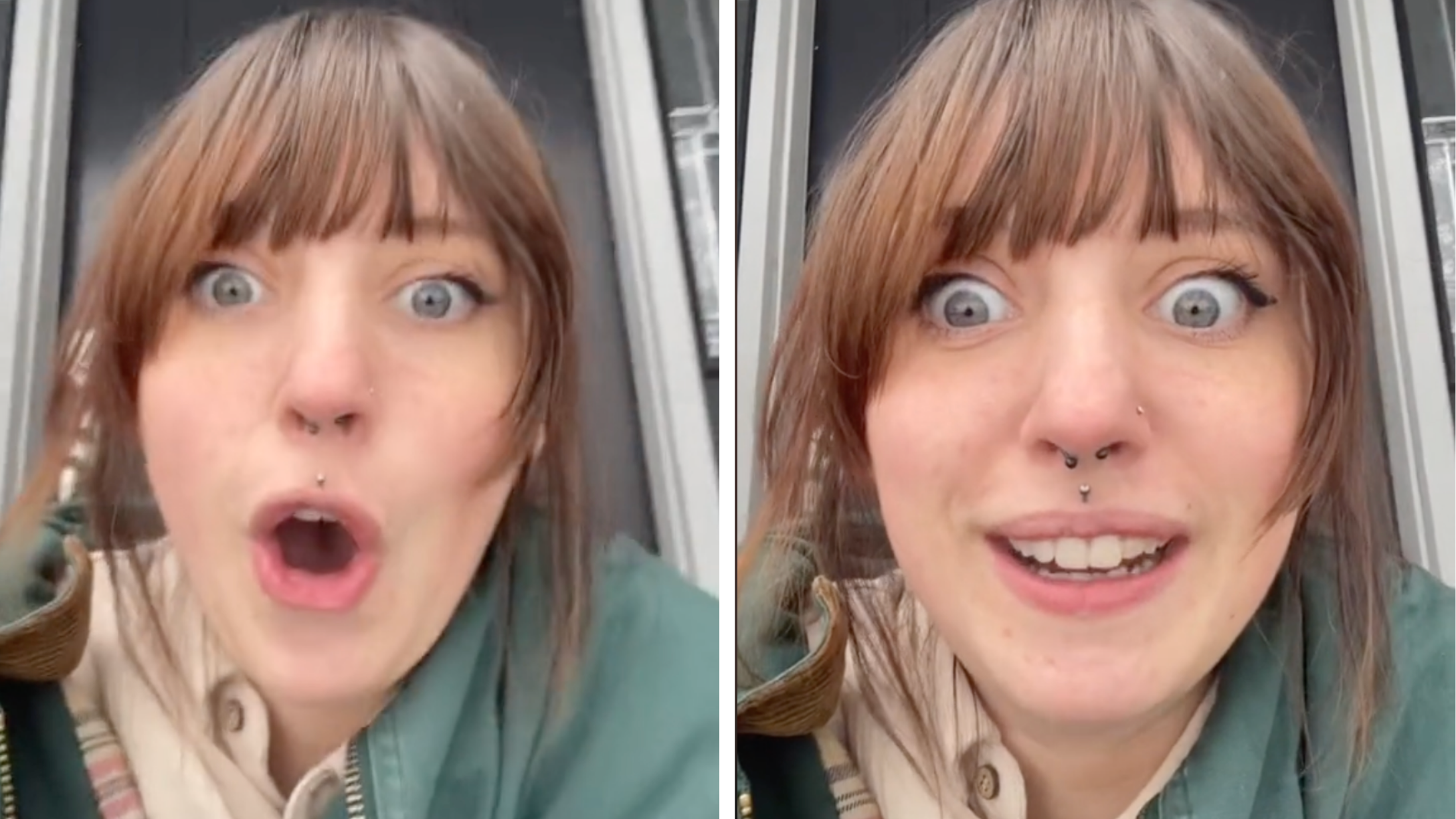 Mom Shares She Had Cyst in Her Uterus Full of Teeth & Hair & Now I'm ...