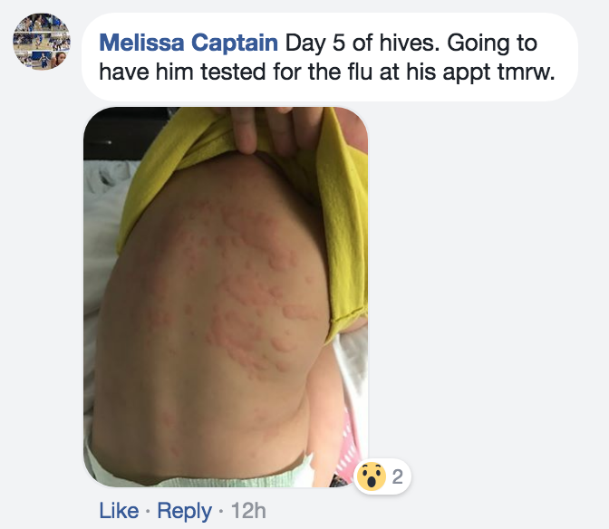 Nurse Warns About New Flu Symptom Most Parents Have Never Seen ...