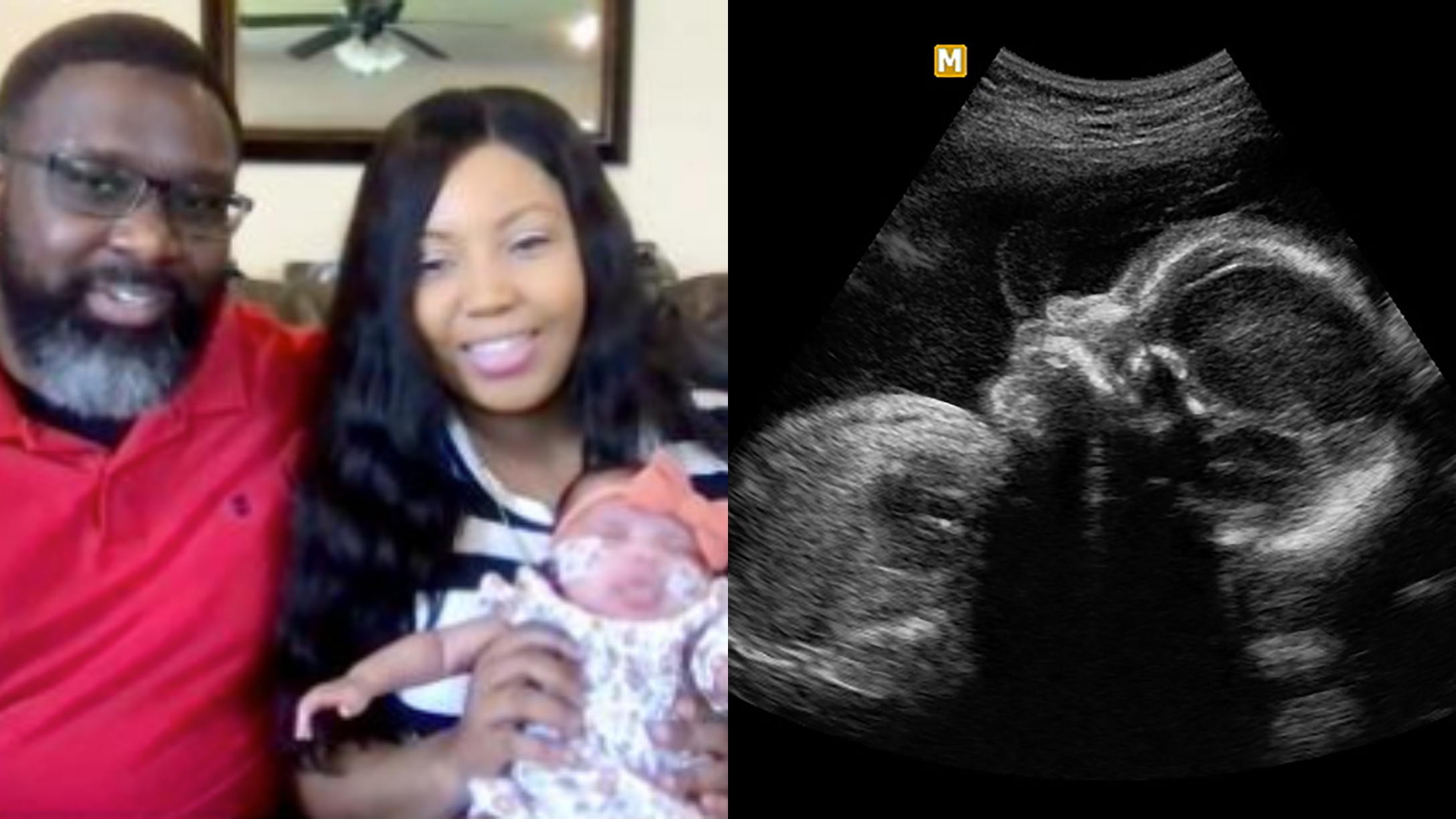 Surgeons Successfully Perform First-Ever Life-Saving Brain Surgery on ...