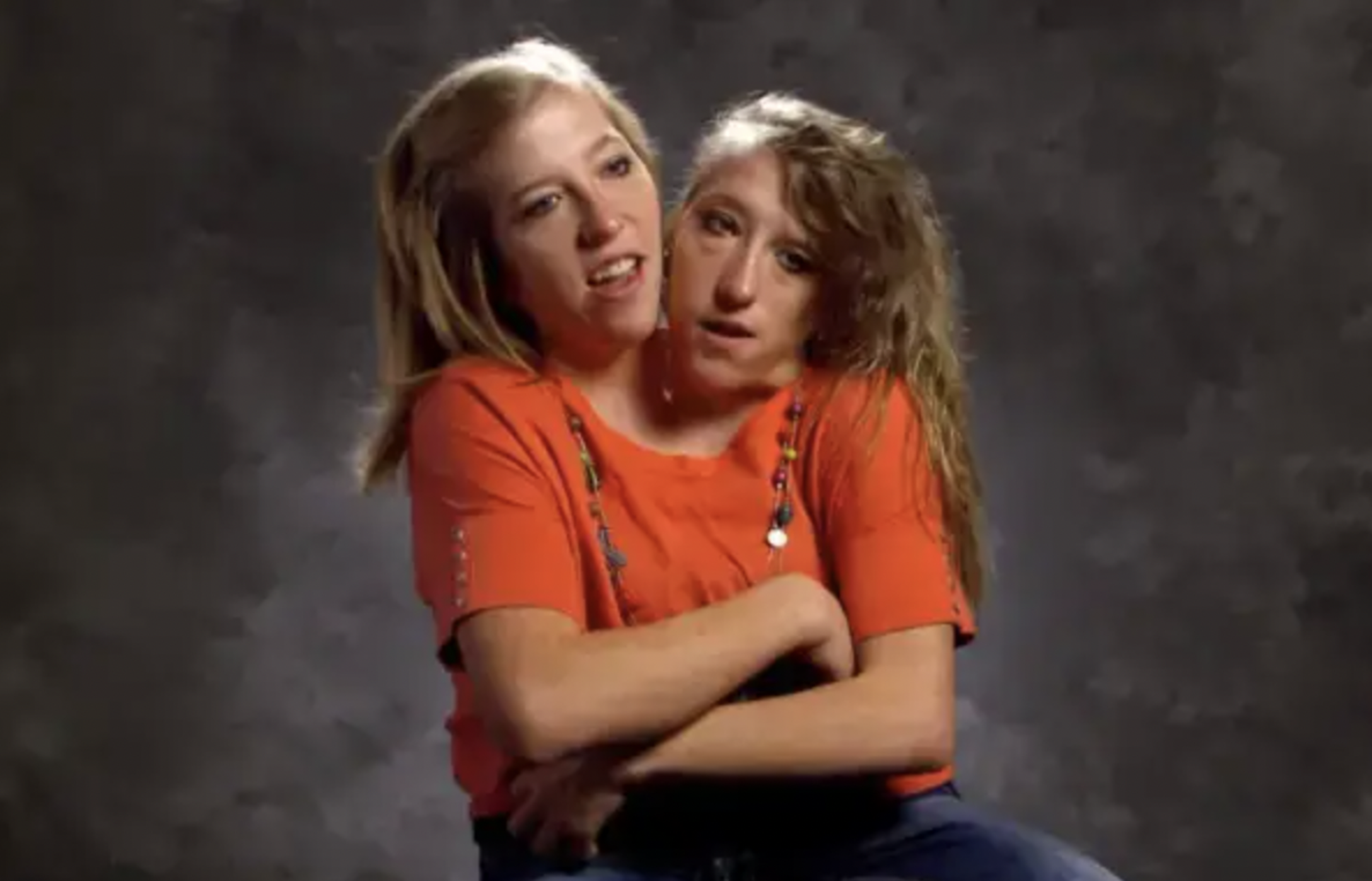 Conjoined Twin Abby Hensel From TLC Show 'Abby & Brittany' Is Now ...