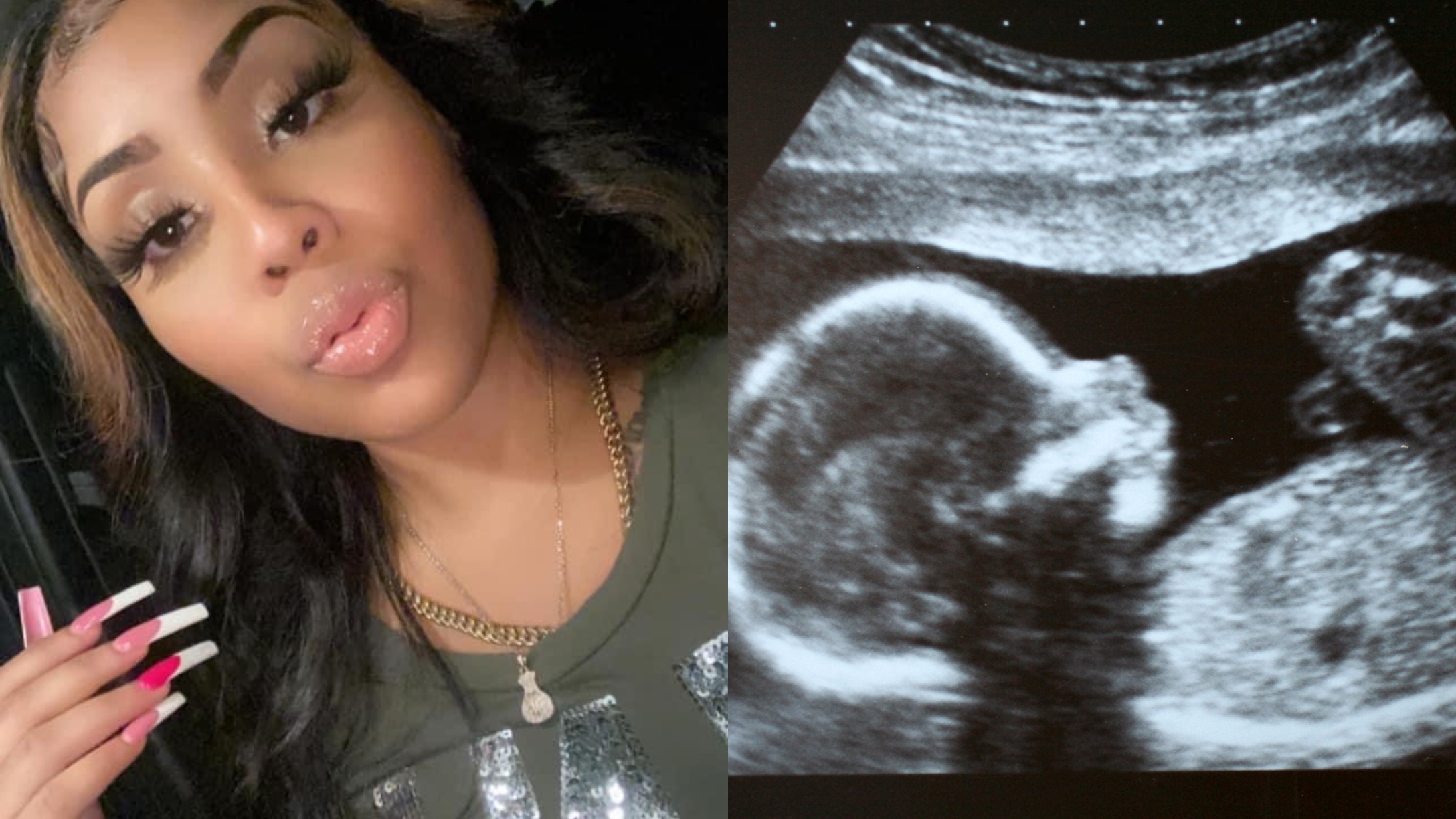 Pregnant Woman Accused of Murder Wants To Be Released From Jail, Says ...