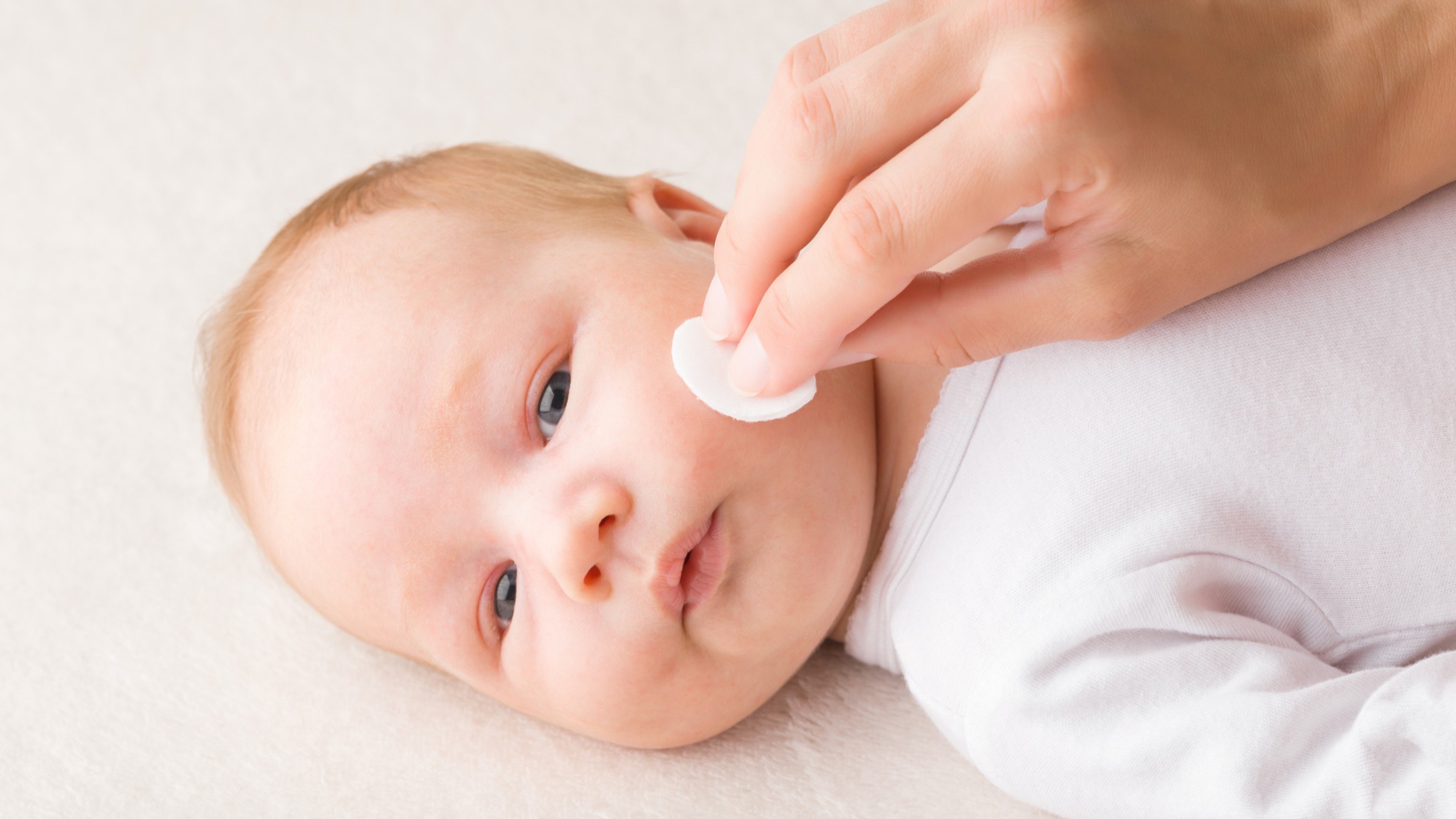 20 Common Kids' Skin Issues Moms Might Not Know About | CafeMom.com