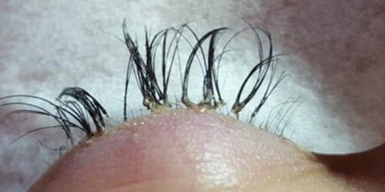 Salon Owner Shares Gruesome Warning About Eyelash Extensions | CafeMom.com