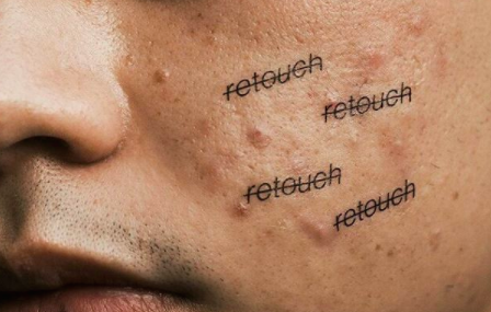 This Powerful Photo Series Celebrates Acne-Prone Skin | CafeMom.com