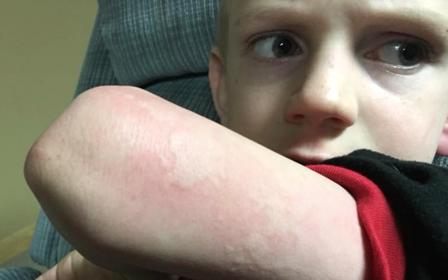 Nurse Warns About New Flu Symptom Most Parents Have Never Seen ...
