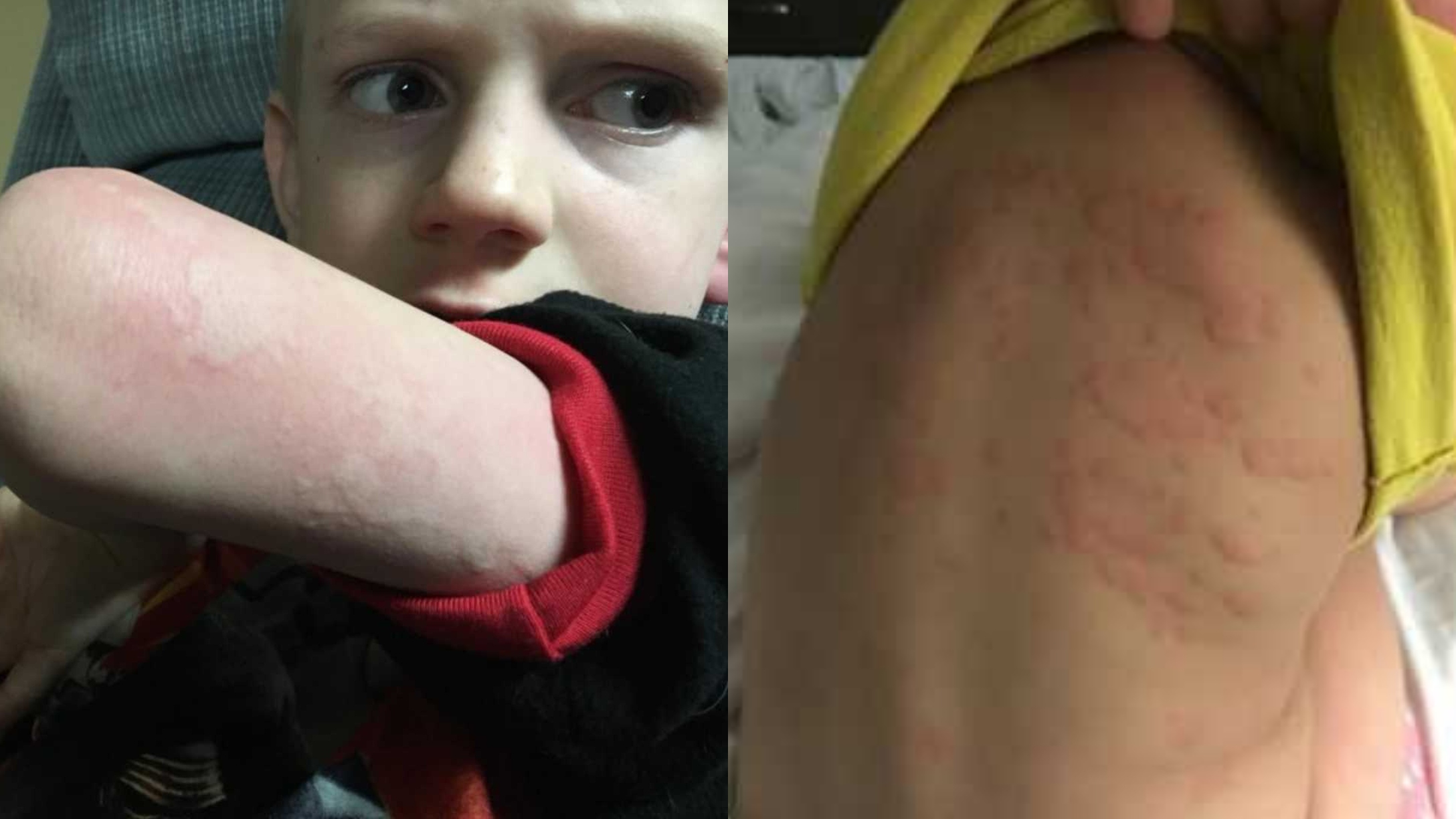 Nurse Warns About New Flu Symptom Most Parents Have Never Seen ...