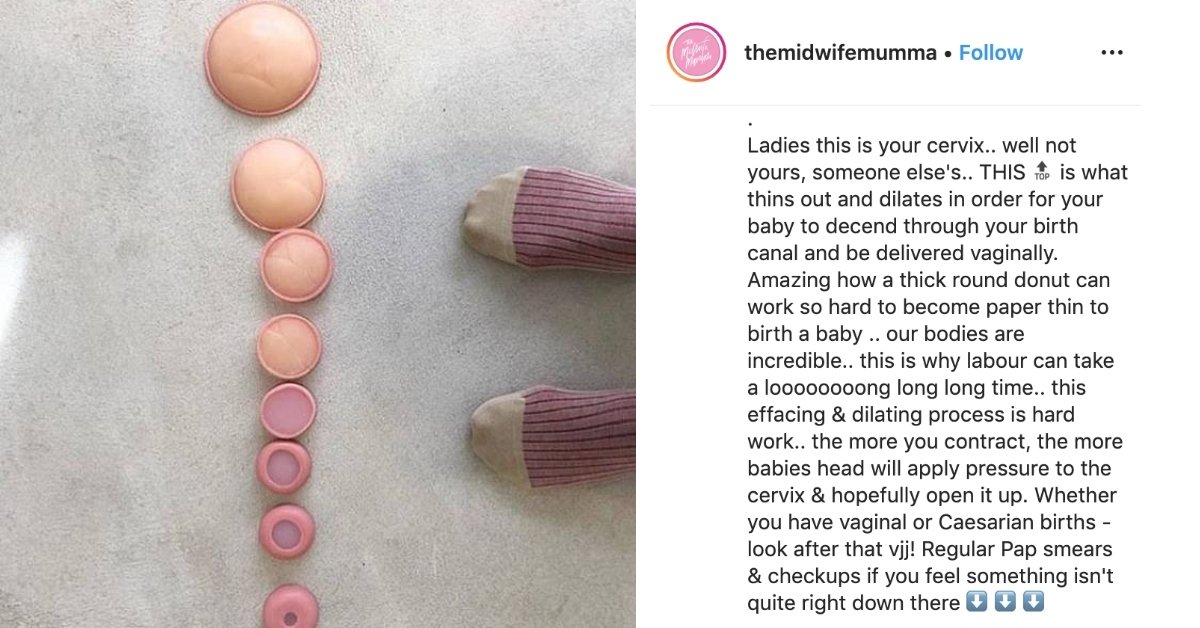 This Is What a Cervix Looks Like & It's Incredible | CafeMom.com