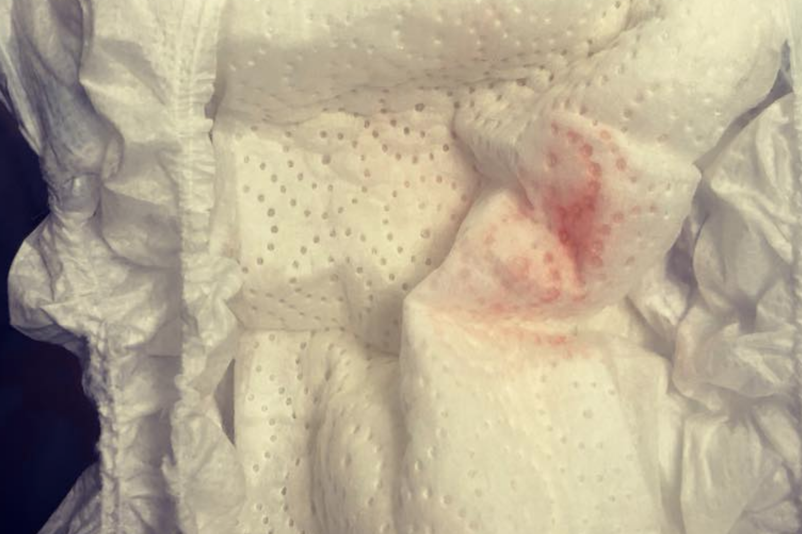 The Weird Thing 1 Mom Found When She Changed Her Kid's Diaper | CafeMom.com