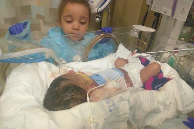 Baby Born Without Skin Receives Life-Saving Transplant | CafeMom.com