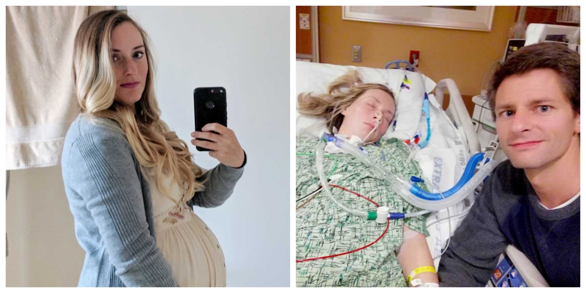 Mom Births Baby While in a Medically Induced Coma | CafeMom.com