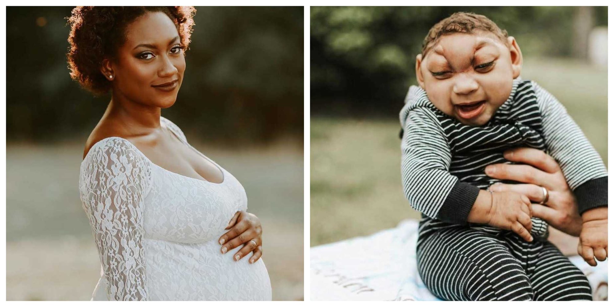 Mom Pens Stirring Post About Baby Born With Microcephaly | CafeMom.com