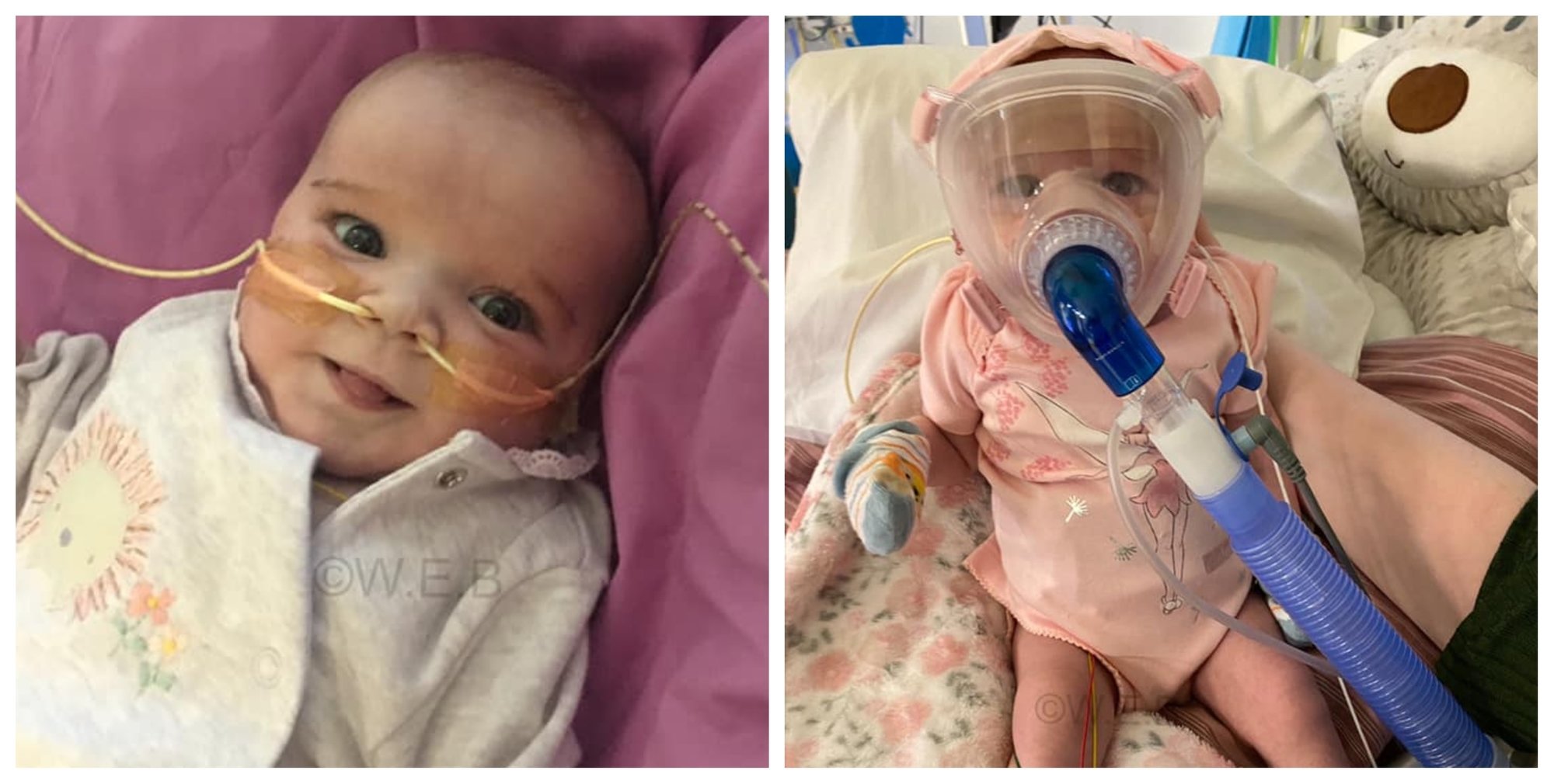 UK 'Miracle Baby' Survives Heart Surgery, Then Coronavirus | CafeMom.com