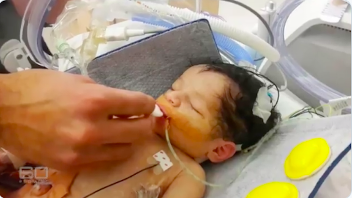 Baby Poisoned After Mix-Up Has Her Inhaling Nitrous Oxide | CafeMom.com